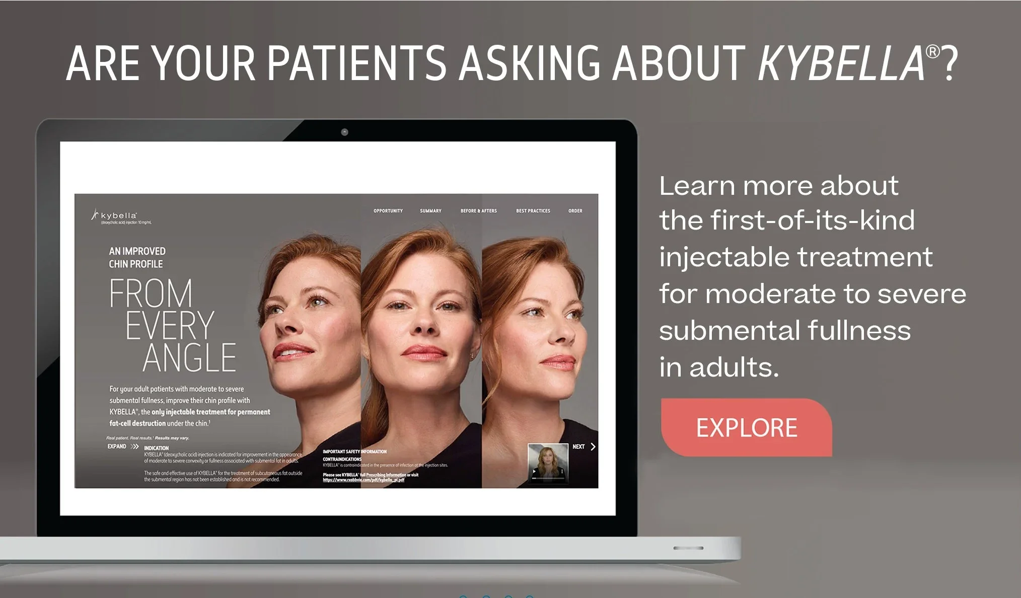 FOR HEALTHCARE PROFESSIONALS | KYBELLA® HCP